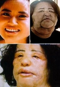 How Plastic Surgery Addiction Destroyed Hang Mioku’s Life